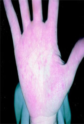 Examples of the most common and problematic soil pollutants